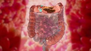 ¿Qué se siente cuando el colon está inflamado?